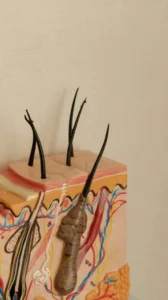 Found this on my son’s scalp. Have no idea what it is and we can’t get ...